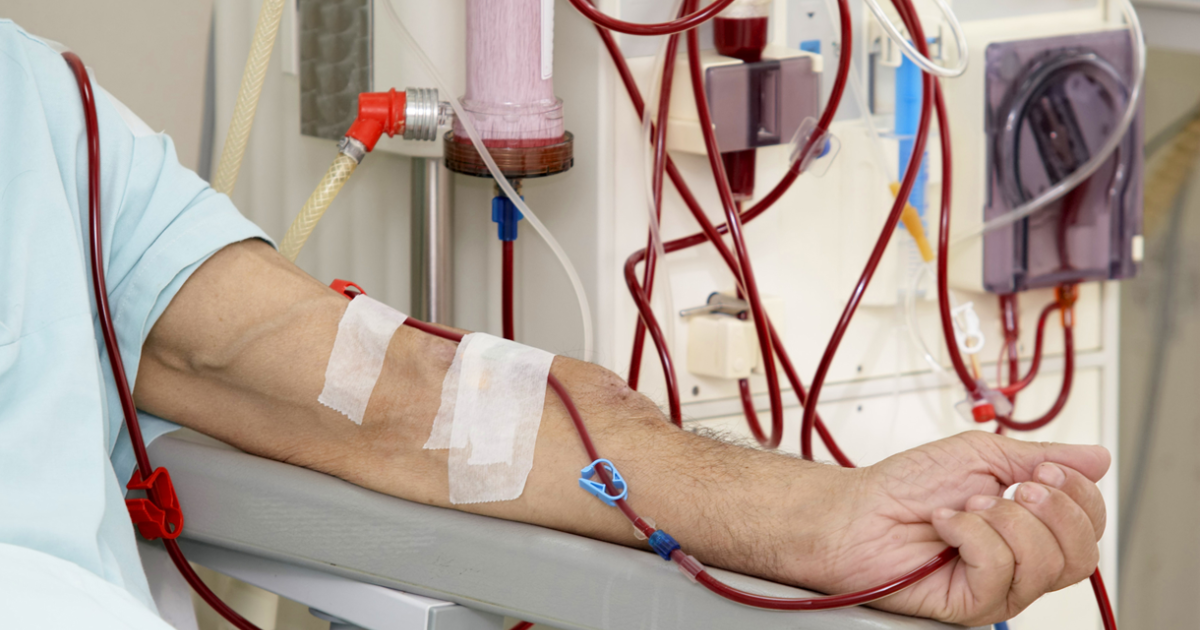 5 vragen over... nierdialyse | PlusOnline