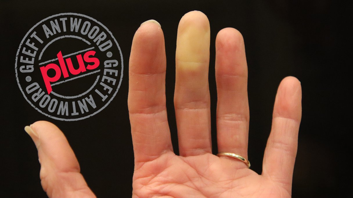 Last van witte gevoelloze vingers of tenen als het koud is? | PlusOnline