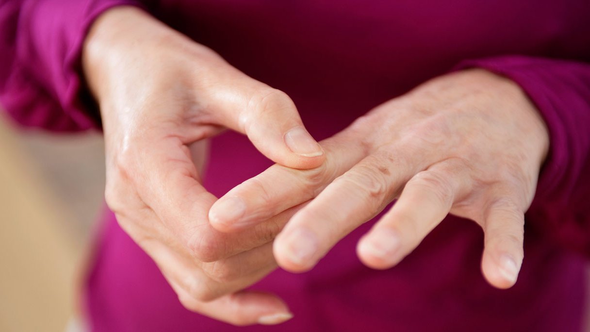 Hoe is een trigger­vinger te verhelpen? | PlusOnline