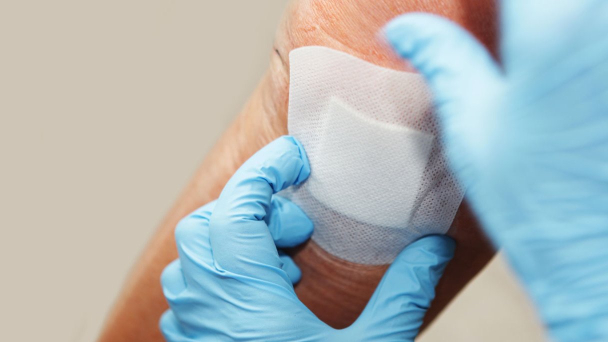 Wanneer je wond maar niet geneest | PlusOnline