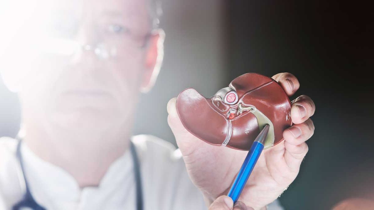 Wat zijn galstenen? | PlusOnline