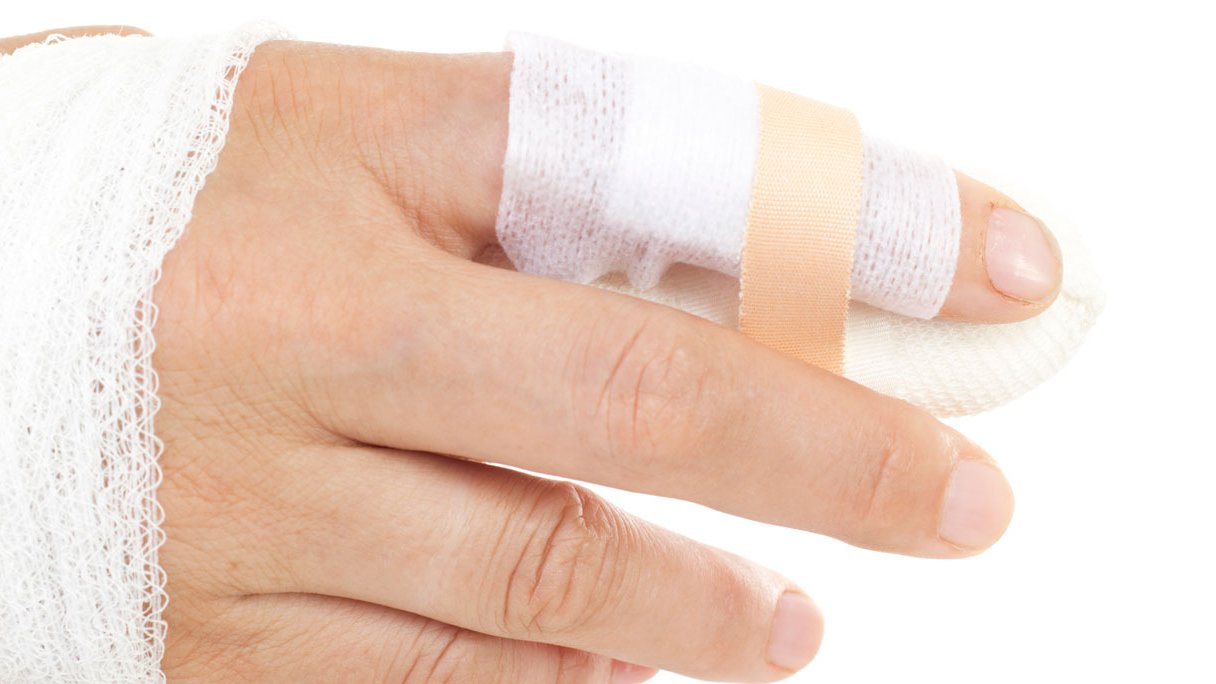 Hoe gevaarlijk is de beet van een kat? | PlusOnline