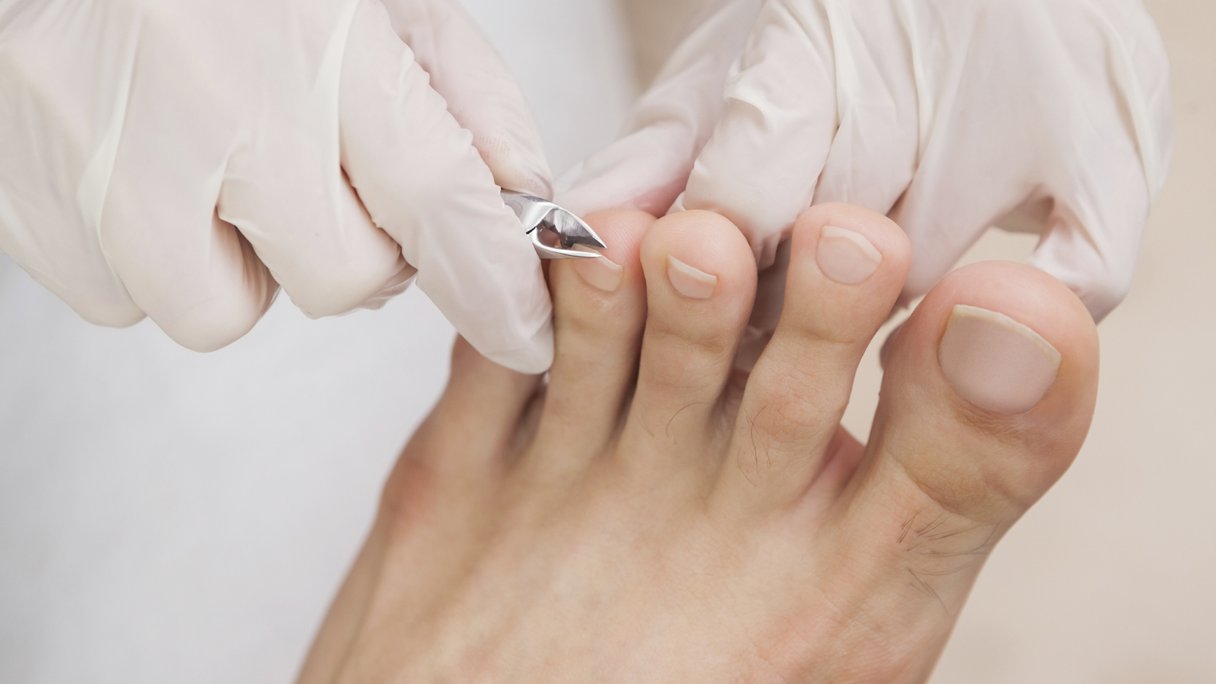 Wratten: alle soorten op een rij | PlusOnline